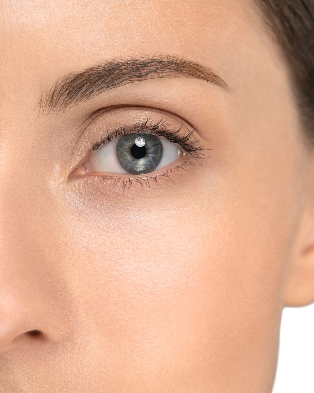 Refresh with Brow Lift Anti-Wrinkle Injections | Nova Clinic – Nova ...