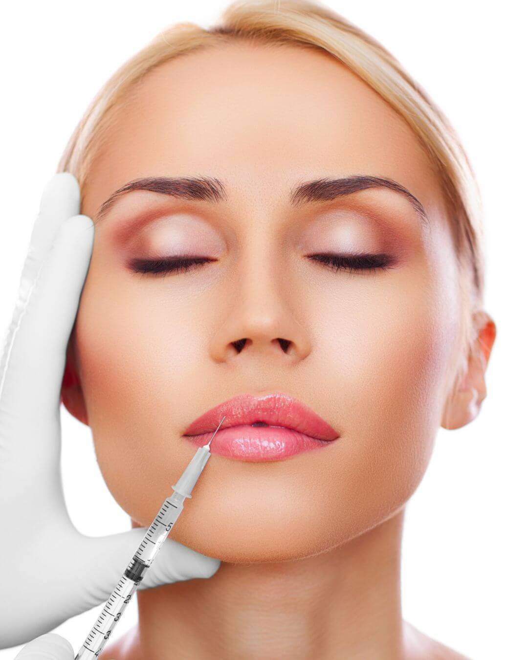 Lip Line Fillers: Smooth Lips & Youthful Look | Sydney's Nova Clinic ...